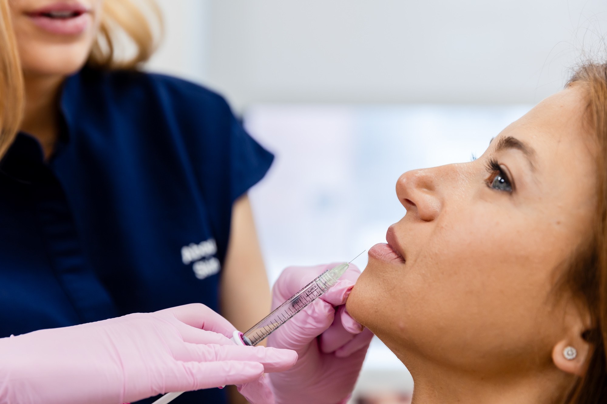 RHA Fillers in Philadelphia | About Face Aesthetics