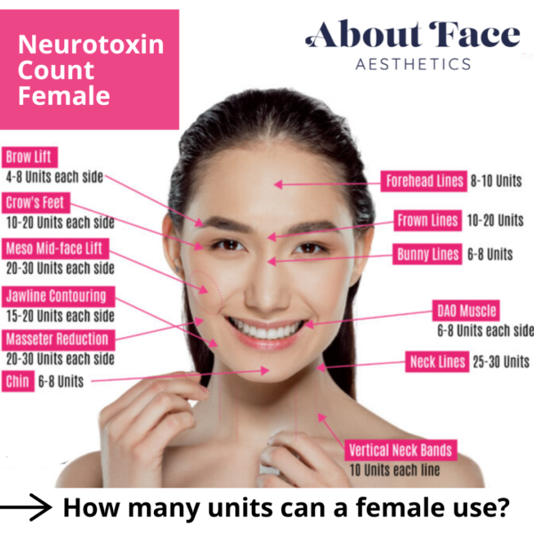 Top 10 Most Popular Botox Facial Injection Sites | About Face Aesthetics